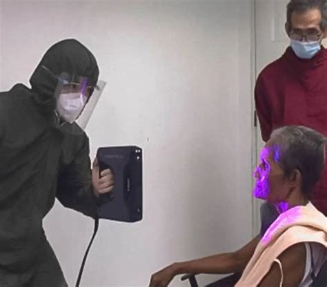 Prótesis digitales D personalizadas con EinScan Shining Scan D Market