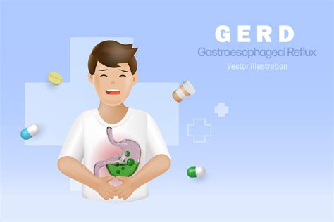 Gerd Gastroesofágico Reflujo ácido En Paciente Estómago Digestivo