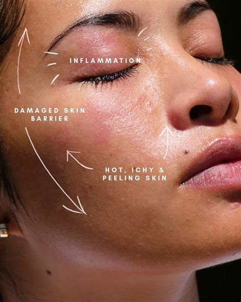What Leads To A Damaged Skin Barrier Ways To Fix It