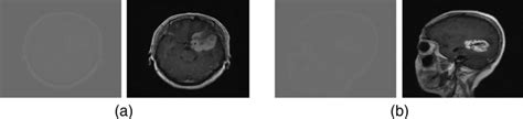 Effect Of Contrast Stretching A Image No 2 In Figshare Original And