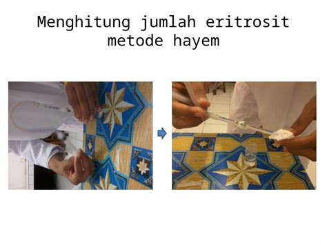 Pptx Menghitung Jumlah Eritrosit Metode Hayem Dokumen Tips