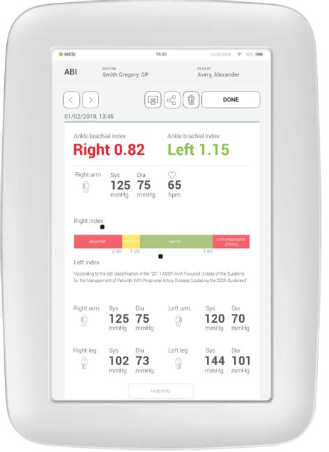 Mesi Mtablet Wireless Ankle Brachial Index Measuring System Smart A