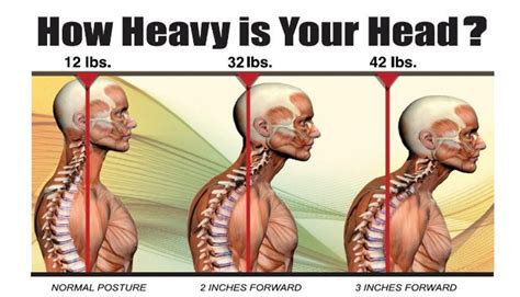 Forward Head Posture Fix Review Proven Program That Works
