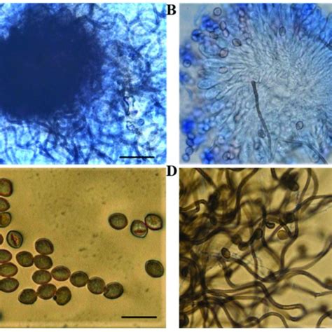 Endophyte F5 Inhibits The Growth Of Five Pathogenic Fungis Mycelia