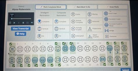 Solved Tooth 2 Has A Class V Restoration On The Buccal And A