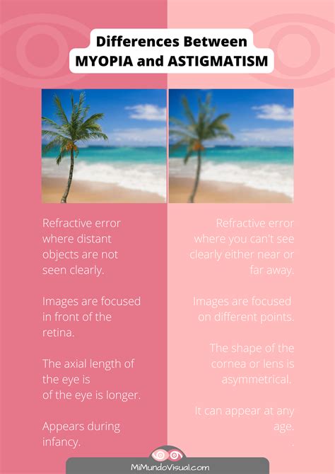 What Is The Difference Between Myopia And Astigmatism Mi Mundo Visual