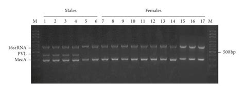 Multiplex Pcr Assay For The Detection Of Pvl And Meca Genes M 100 Bp