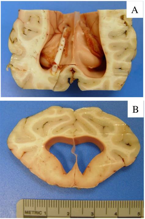 Choroid Plexus Sheep Brain
