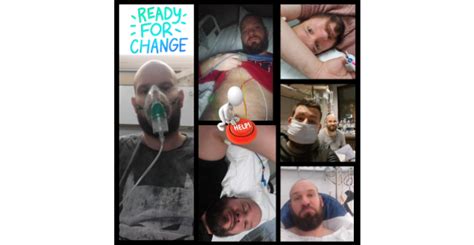 Steun Long Covid Patiënt Tom Voor Zijn Hyperbare Crowdfunding Steunactie