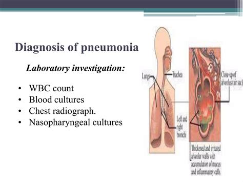 Pediatric Pneumonia Pptx Lung And Respiratory Health Diseases And Conditions