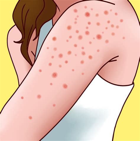 8 Signes Que Ta Santé Immunitaire Tire La Sonnette Dalarme Sympa