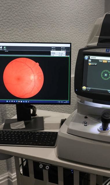 Optomap Retinal Scan Our Ultimate Eye Exam Bayfields Opticians