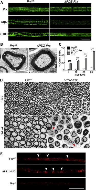 Δpdz Prx Peripheral Nerves Have An Ameliorated Phenotype Compared To