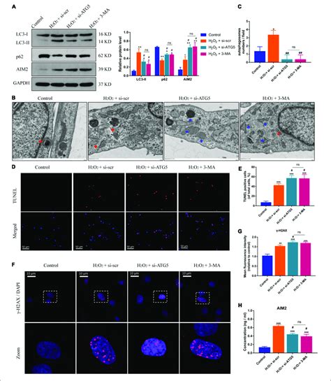 Inhibition Of Autophagy Aggravates Dna Damage And Np Cell Apoptosis