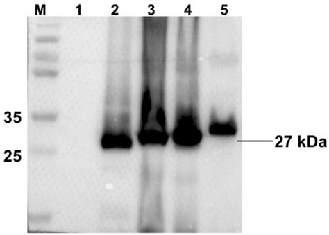 Western Blot Analysis Of Recombinant Proteins Expression In Sf9 Cells