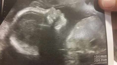 Ecografía De 26 Semanas De Gestación De Mateo Valentín 🤰🏼 Etapas Del