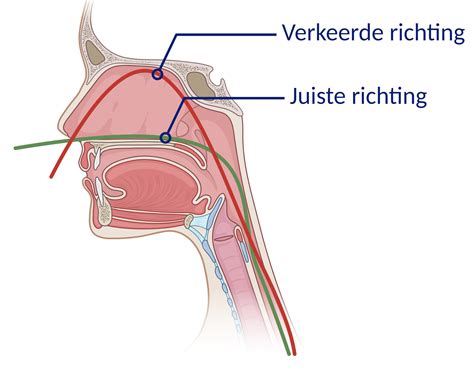 Inbrengen Van Een Maagsonde Patiëntenfolder Erasmus Mc