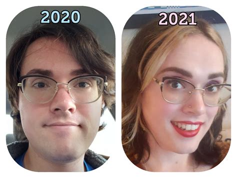One Year Ago Today I Started Hormone Therapy My Life Is So Much