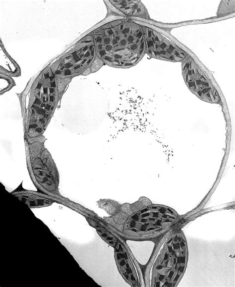 Central Vacuole Under Microscope