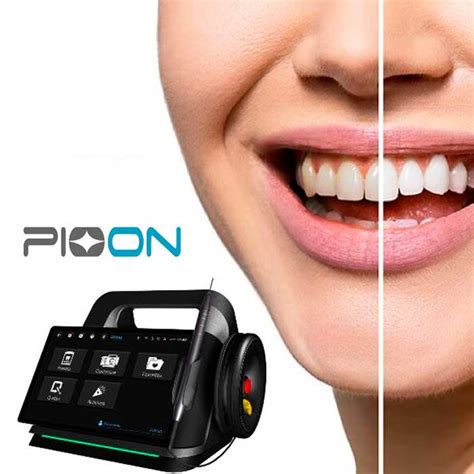 Pioon Laser Teeth Whitening Bogotá Colombia Dental Clinic Dientes