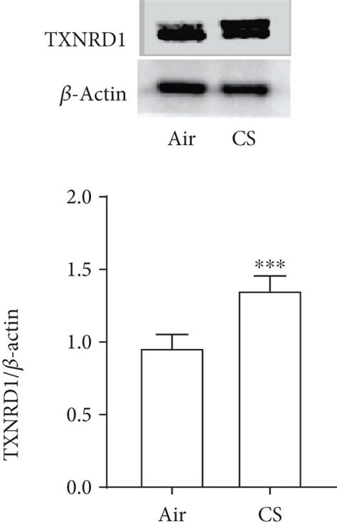Western Blotting To Analyze The Protein Expression Of Txnrd1 The Download Scientific Diagram