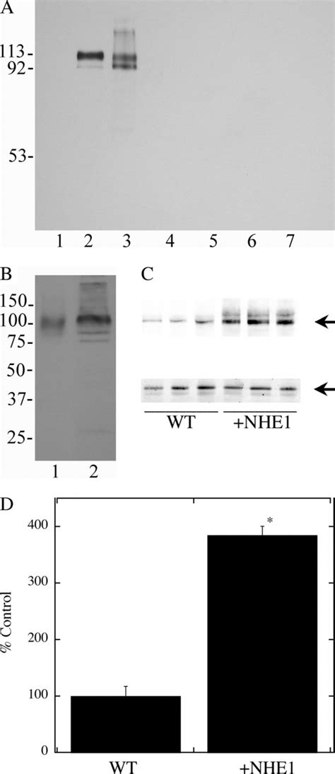 Western Blot Analysis Of Transgenic Mice Examined For Expression Of