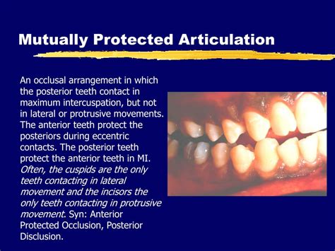 Ppt Fsbgd Occlusion Review Powerpoint Presentation Free Download