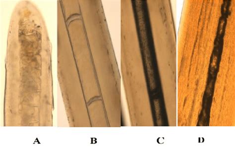 A Medullary Pattern In Proximal Part Of Hair B And C Medullary Pattern Download Scientific