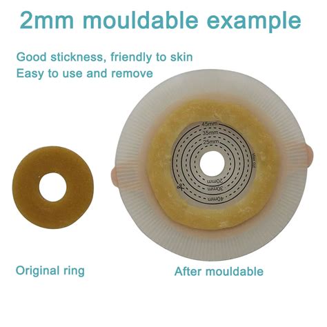 Ostomy Paste Vs Ring At John Heidt Blog