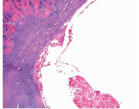 Pathology Of The Ear Ento Key