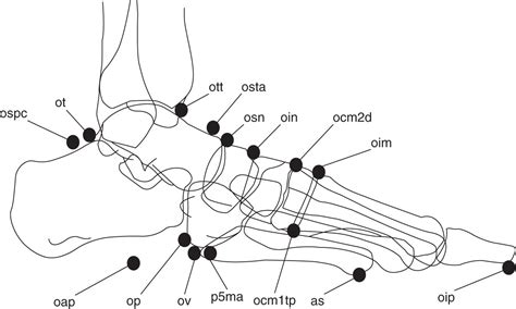 6 Normal Variants And Anomalies Musculoskeletal Key
