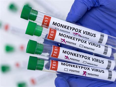 Africa Cdc Backs Moroccos Homegrown Mpox Test