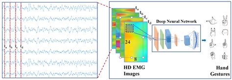 Github Mic Laboratorycnn Hd Semg Classifier This Is An