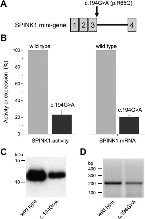 Exonic Variants Affecting Pre Mrna Splicing Add To Genetic Burden In