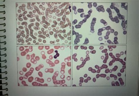 Lab Practical 1 Study Of Red Blood Cells RBCs And Associated