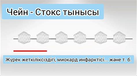 Чейн Стокс тынысы Youtube