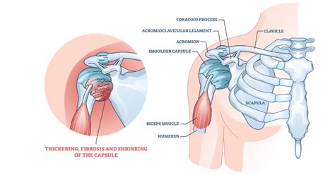 Subscapularis Rotator Cuff Muscle Yoganatomy