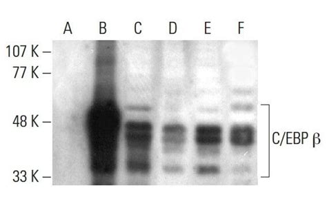 Cebp β Antibody Δ 198 Scbt Santa Cruz Biotechnology