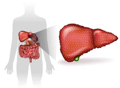 Albumin Confers Survival Benefit In Select Patients With Cirrhosis