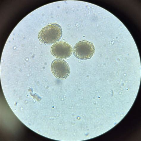 Scarlett Castro On Linkedin ~parasitology Toxocara Spp Eggs Found In 🐶 Stool Using Flotation…