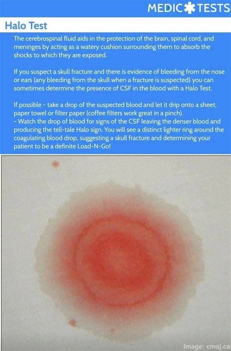 Medictests 1 In Emt And Paramedic Nremt Practice Tests Artofit