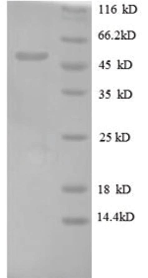 Enquirebio Recombinant Human Oncostatin M Osm Protein 50μg