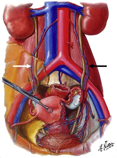 Ovarian Vein Anatomy Left Gonadal Vein The Anatomy Of The Veins