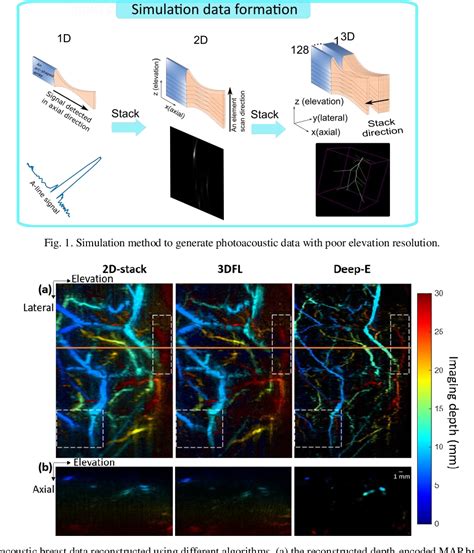 Pdf Deep Learning Enhanced Three Dimensional Photoacoustic Tomography