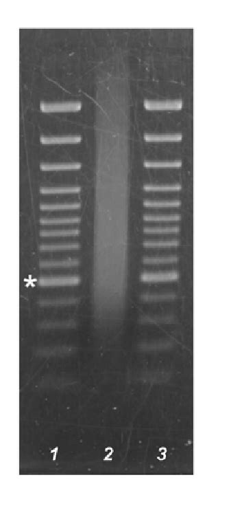 Gdna Isolated From The Splenic Tissue Patient 1 Gdna In Lane 2 5 µl Download Scientific