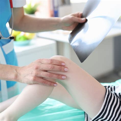 Dysplasie Fibreuse Des Os Dfo Maladies Osseuses Rares