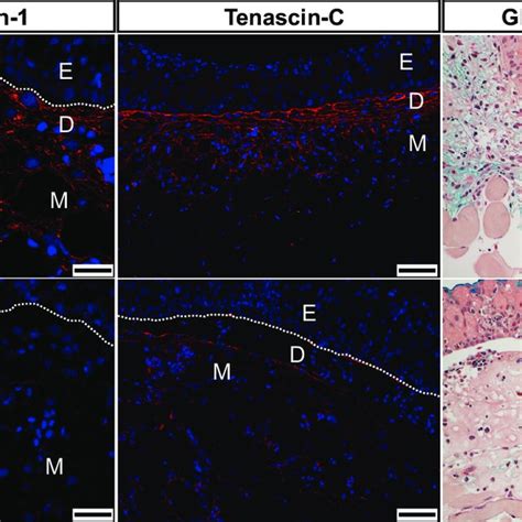 Ben Inhibits Early Deposition Of Extracellular Matrix Ecm Proteins