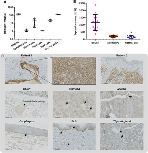 Evaluation Of Cd123 Expression In Normal Cells Compared With Bpdcn