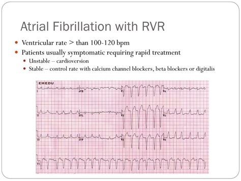 Afib With Rvr Treatment