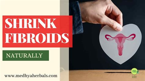 Shrink Fibroids Naturally Artofit